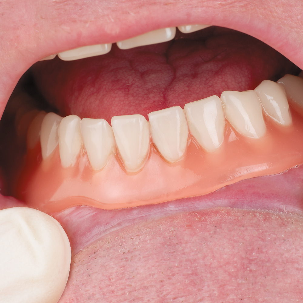 Mucopren soft Basic Set - Optident