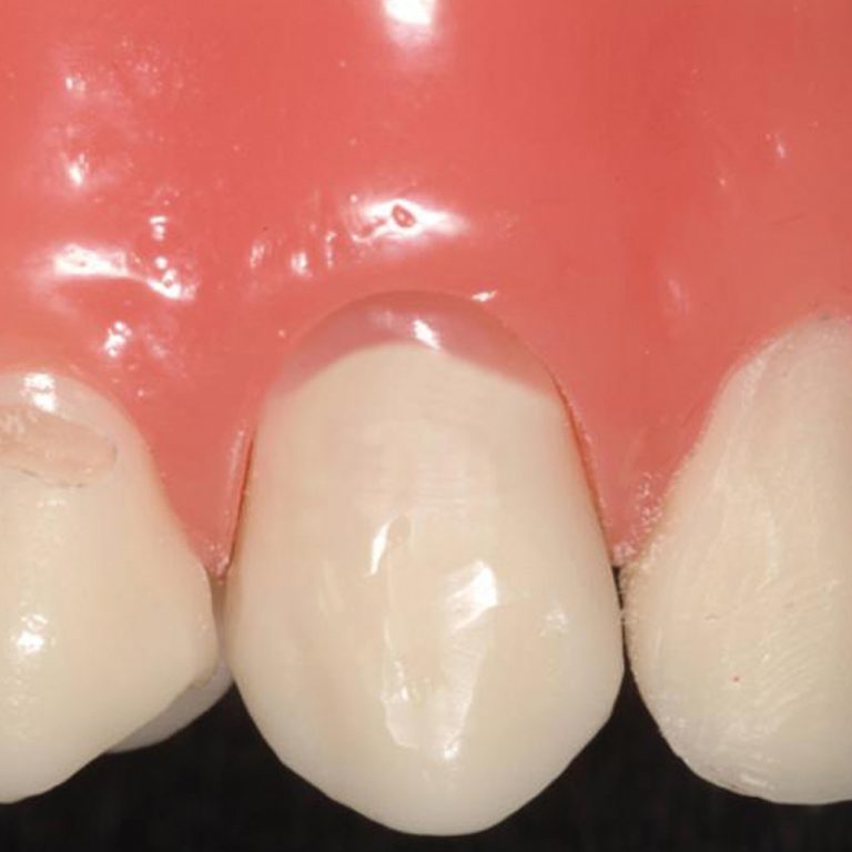 Permaflo Pink - Optident - Specialist Dental Products And Courses