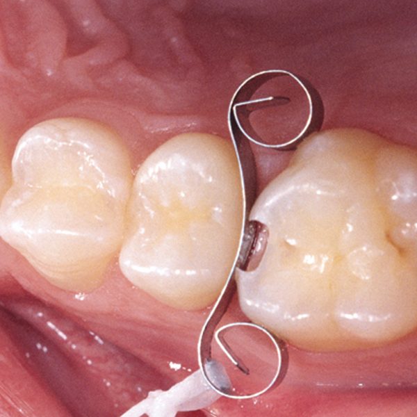 Interguard Intro Kit - Optident - Specialist Dental Products And Courses