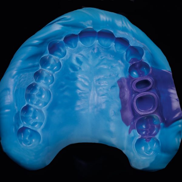 Identium Heavy Intro Pack - Optident - Specialist Dental Products And ...