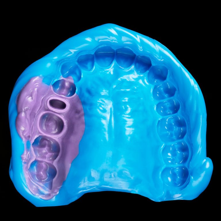 Identium Light Fast - Optident - Specialist Dental Products And Courses