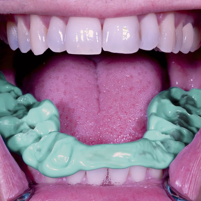 Futar - Optident - Specialist Dental Products And Courses