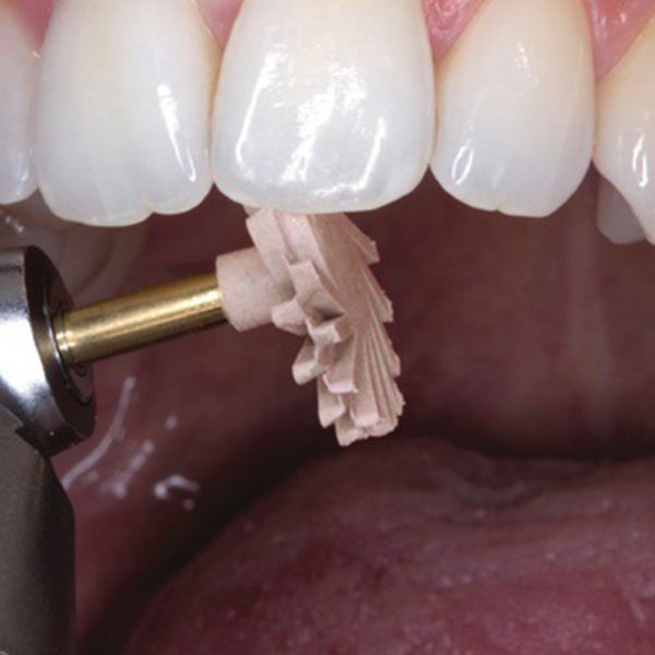 ASAP Assorted Starter Kit - Optident - Specialist Dental Products And ...