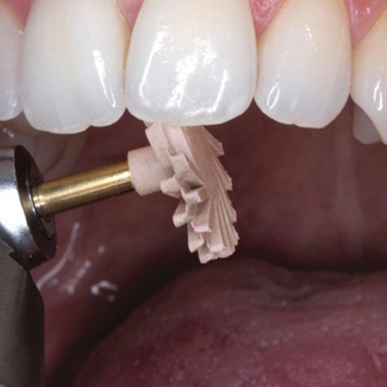 ASAP Assorted Starter Kit - Optident - Specialist Dental Products And ...