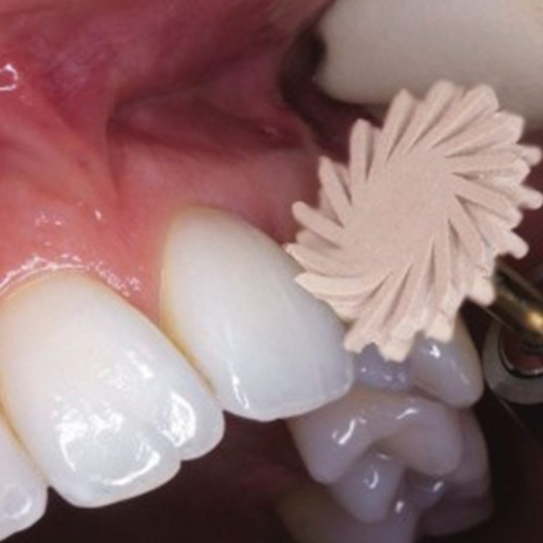 ASAP Assorted Starter Kit - Optident - Specialist Dental Products And ...