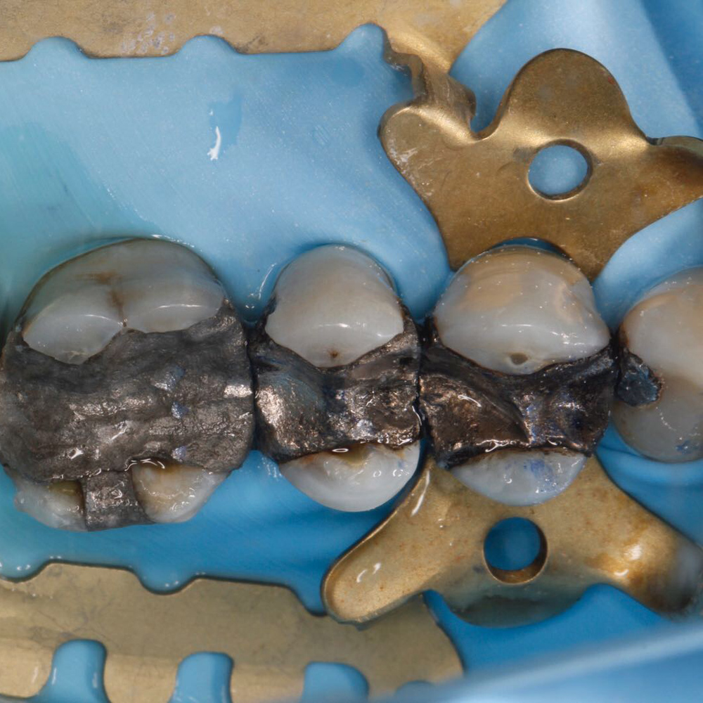 UK1181578OPA - Optident - Specialist Dental Products And Courses