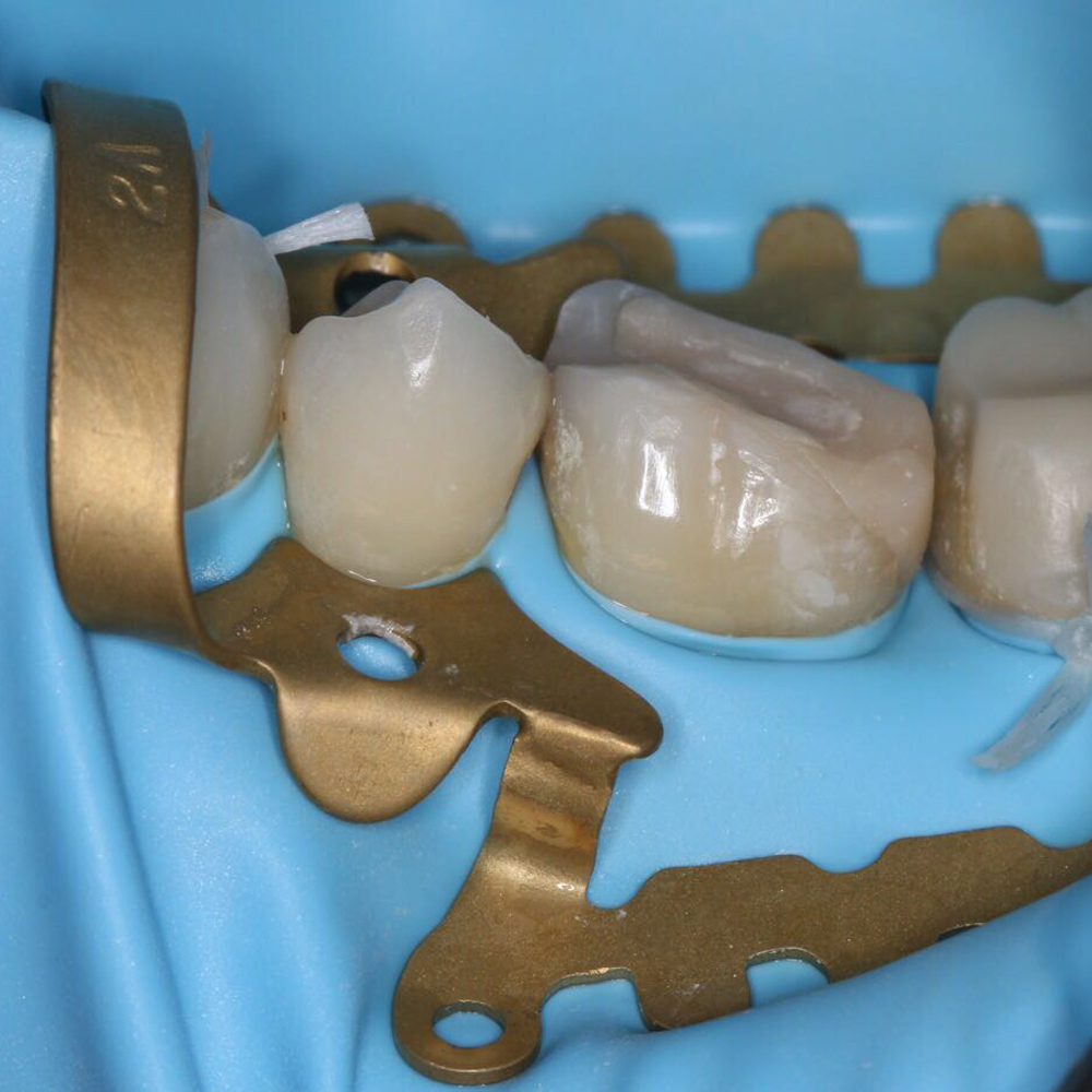 UK1181583OPD - Optident - Specialist Dental Products And Courses