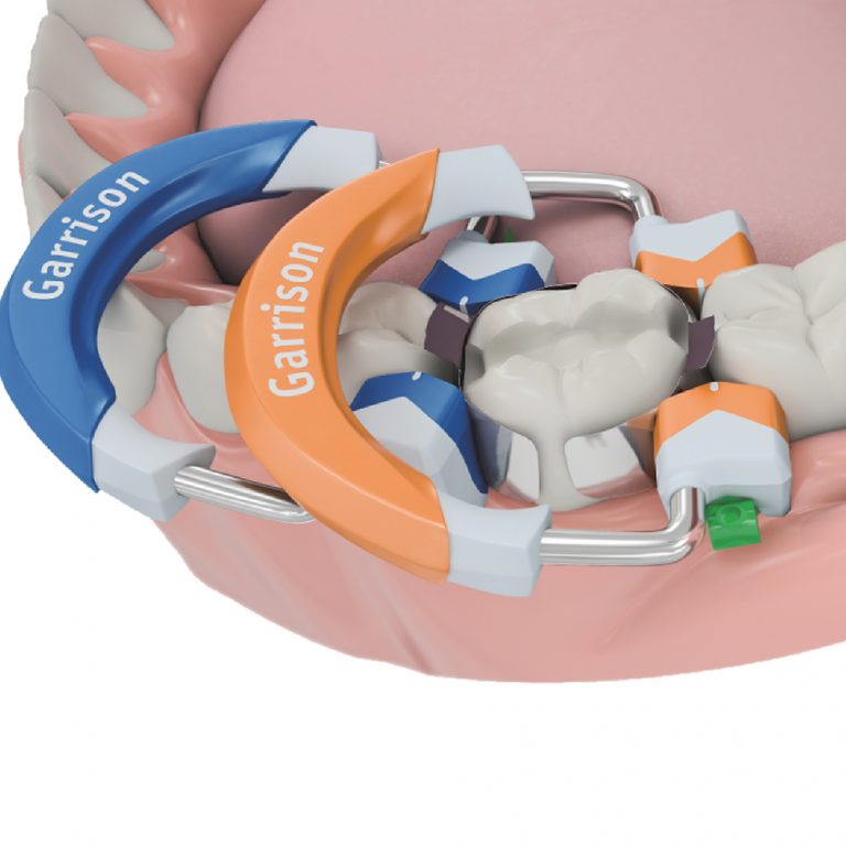 Composi-Tight 3D Fusion Matrix Kit - Optident - Specialist Dental ...